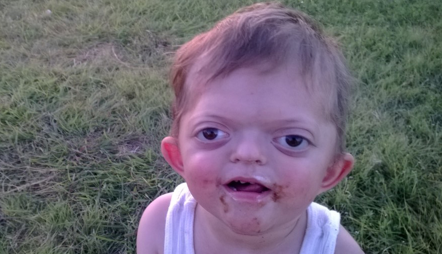 Mom Responds To Bullies Who Made Cruel Meme Of Son With Rare Disorder Mom Responds To Bullies Who Made Cruel Meme Of Son With Rare Disorder