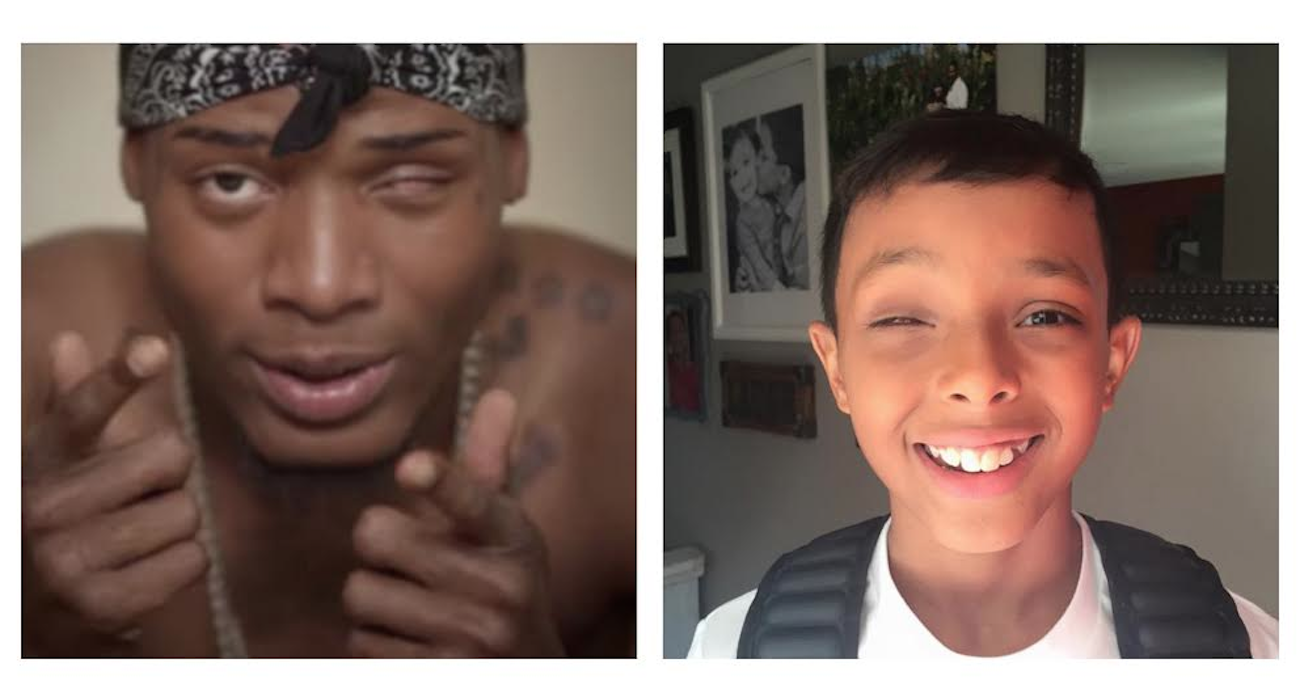 Rapper Fetty Wap Gave Boy Missing an Eye Something His Parents Couldn't