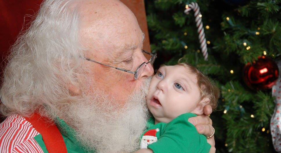 Boy Born With Partial Skull Meets Santa For The First Time, 40% OFF