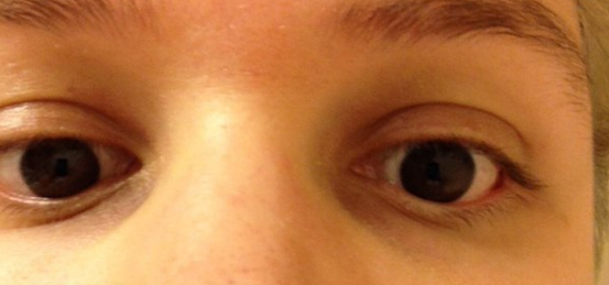 People With Autism Are Tweeting Photos of Their Eyes to Make an ...