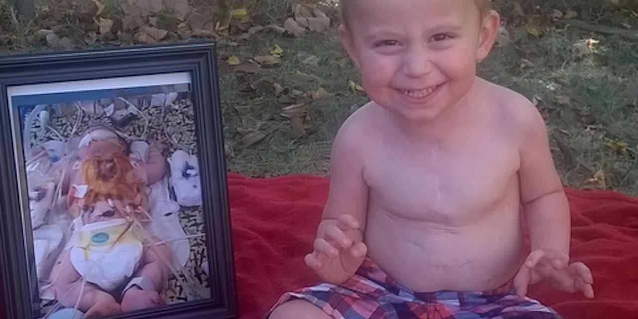 To the Doctor Who Urged Me to Abort My Child With a Heart Defect