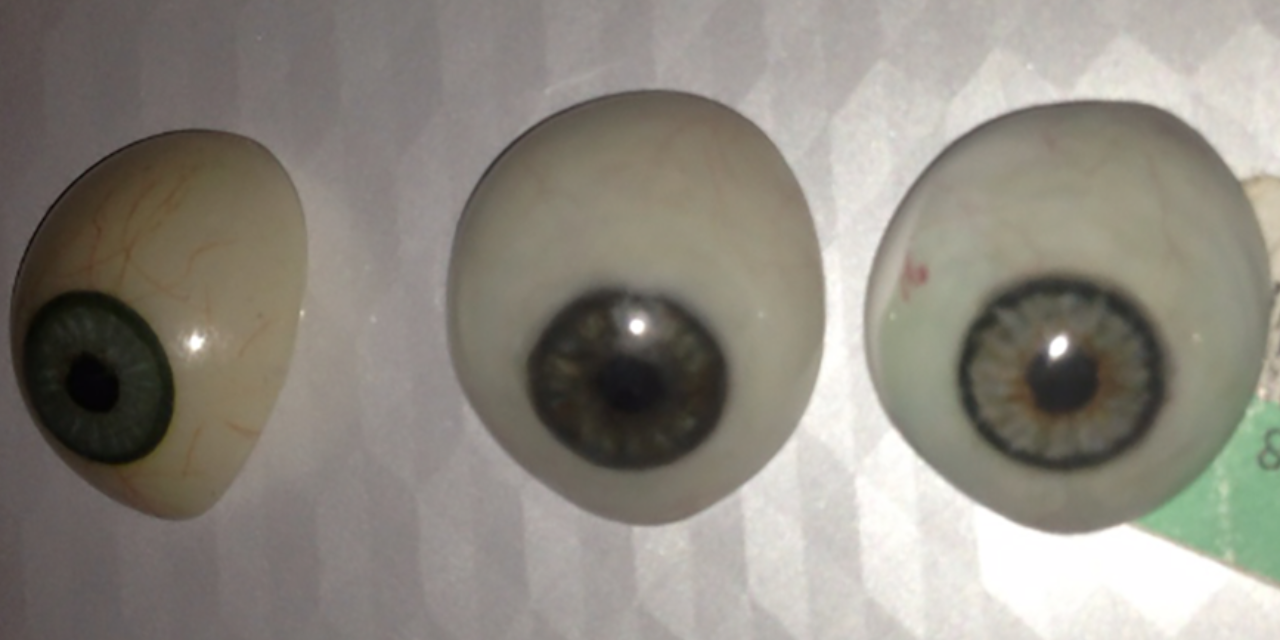 13 Questions I've Been Asked About My Eye Prosthetic