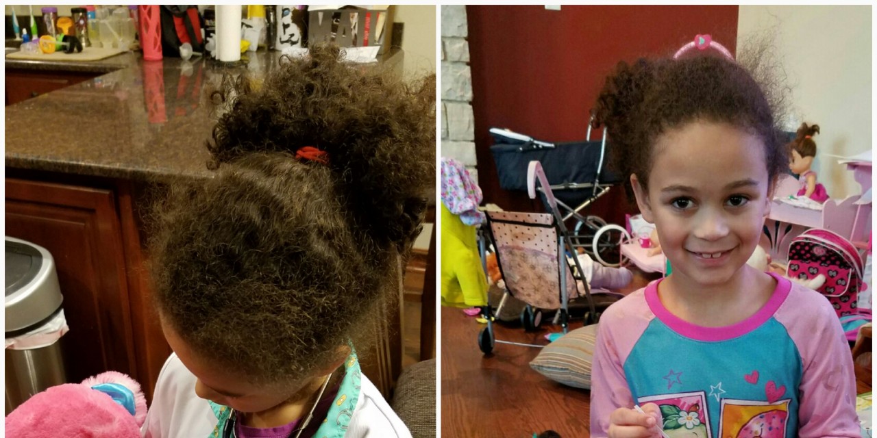 7 Pictures Showing How Life Can Be Affected by Propionic Acidemia