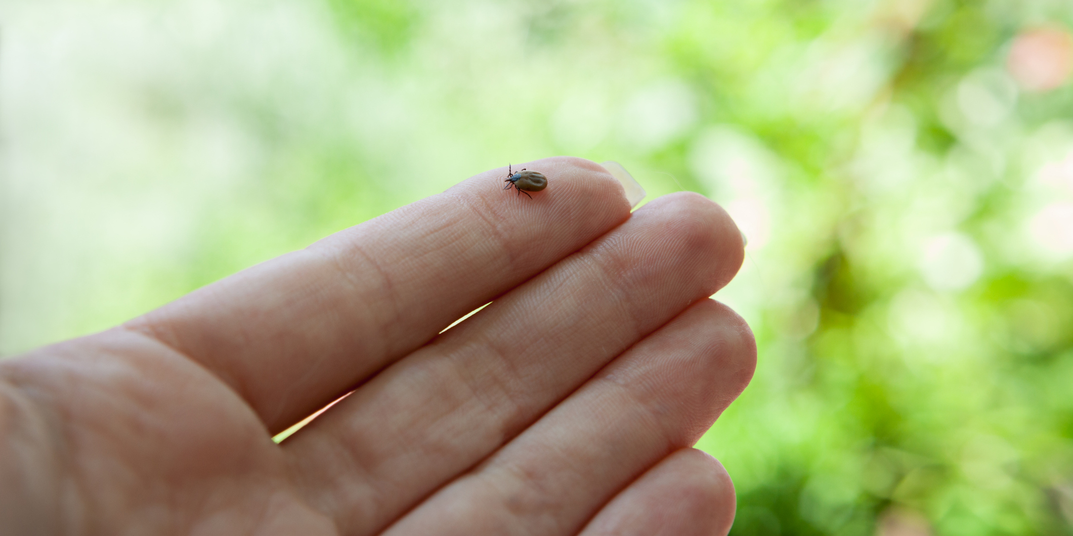How I'm Managing My Fear of Ticks After Getting Lyme Disease