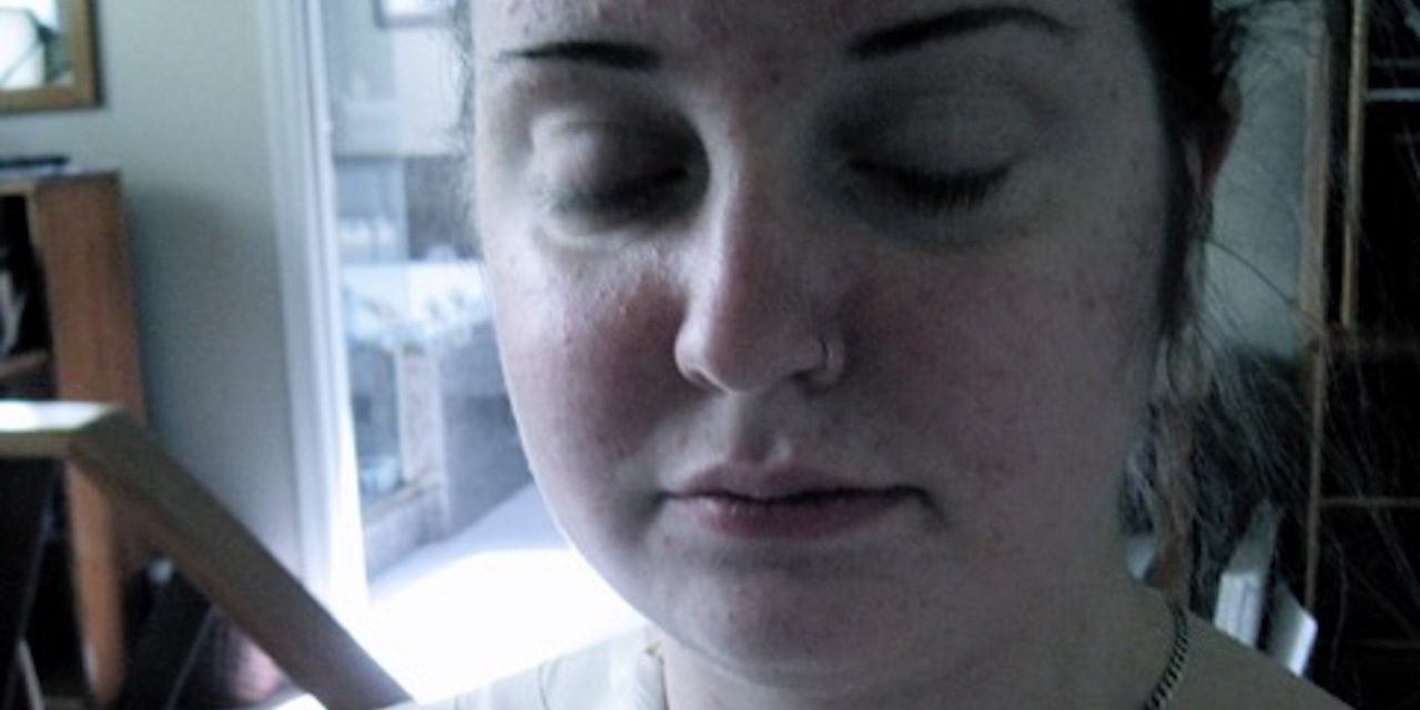 Why I'm Finally Sharing This Photo From My Lupus Treatment
