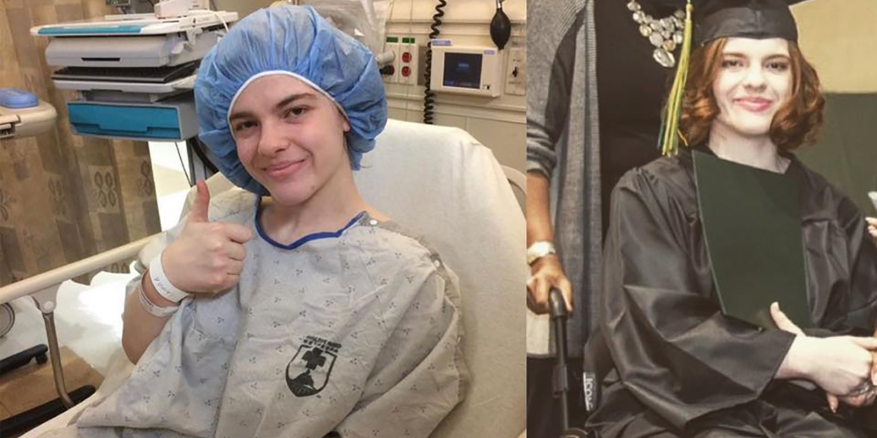 Why It's Important to Celebrate Surgeries Years Later