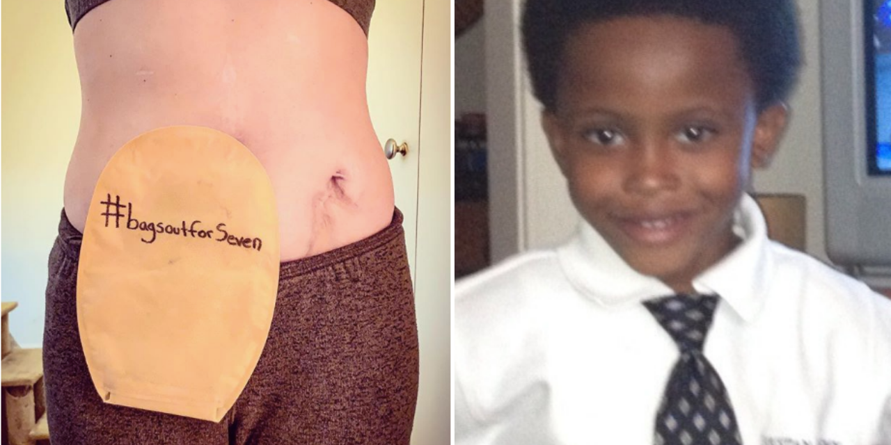 People Share Ostomy Photos on Instagram Following 10-Year-Old Boy's Suicide