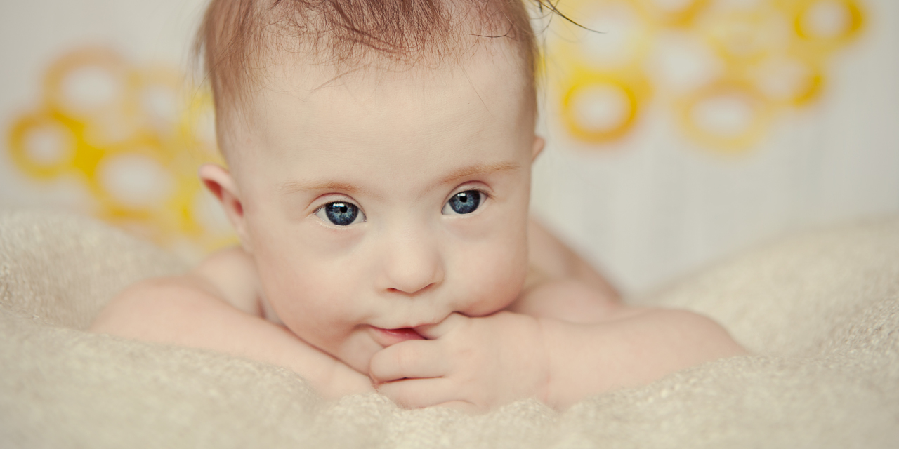 Supporting New Parents of a Baby With Down Syndrome